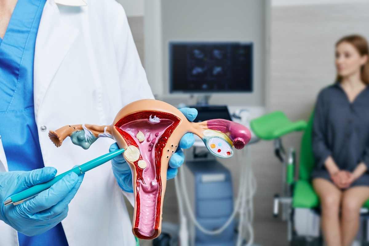 Qu’est-ce qu’un fibrome? - FIV Américaine à Chypre