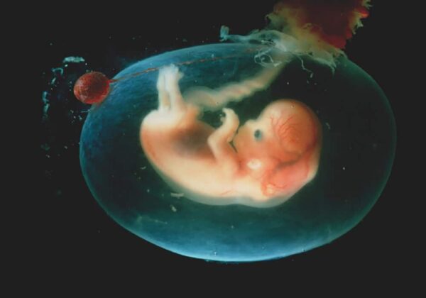What is the Amniotic Sac ? - Cyprus American IVF Center
